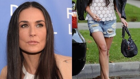 Star e cellulite: tutti i difetti sulle gambe delle celebrities