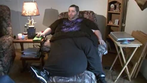 L'uomo con lo scroto di 45 kg è stato operato